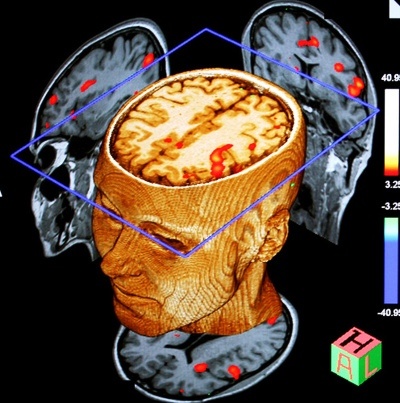 WAYNE RADIOLOGY CENTER - Wayne NJ - Hours, Directions, Reviews - Loc8NearMe